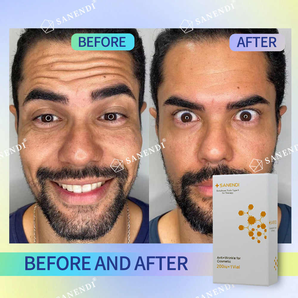 Sanendi 200U Anti Wrinkle