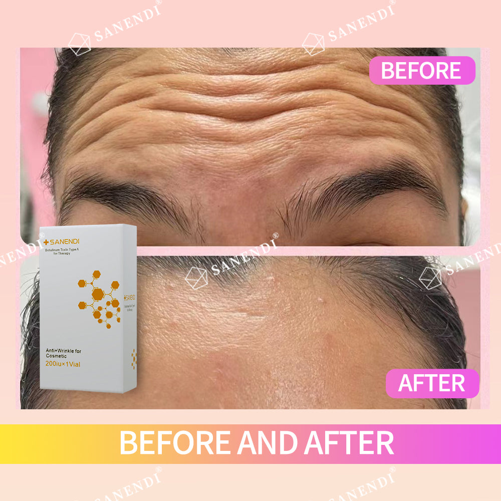 Sanendi 200U Anti Wrinkle